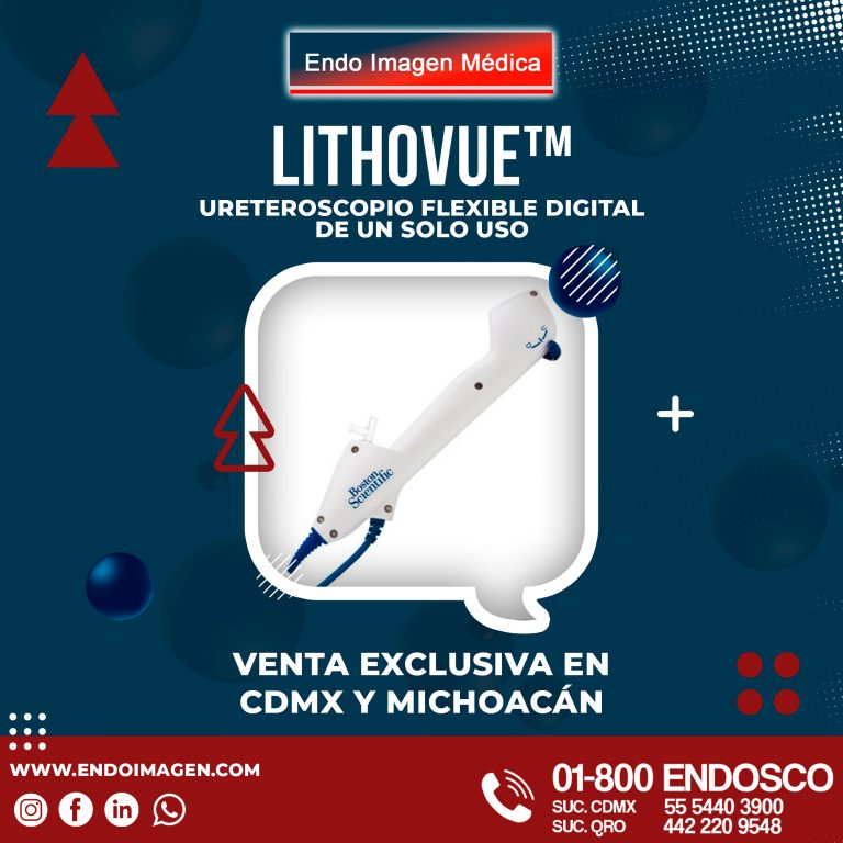 LITHOVUE™ – Endo Imagen Médica